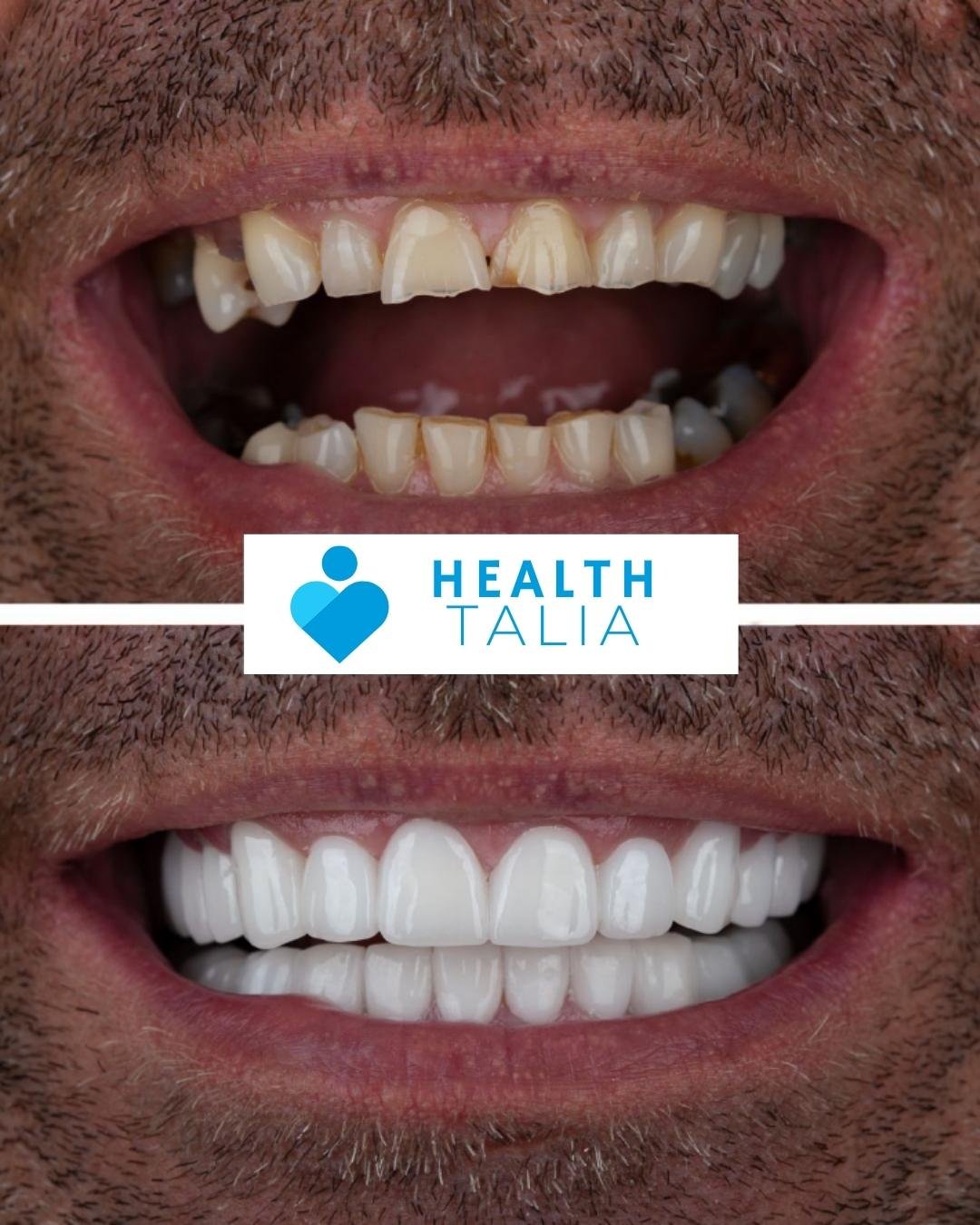 Health Talia Turkey Smiles - Turkey Health Talia