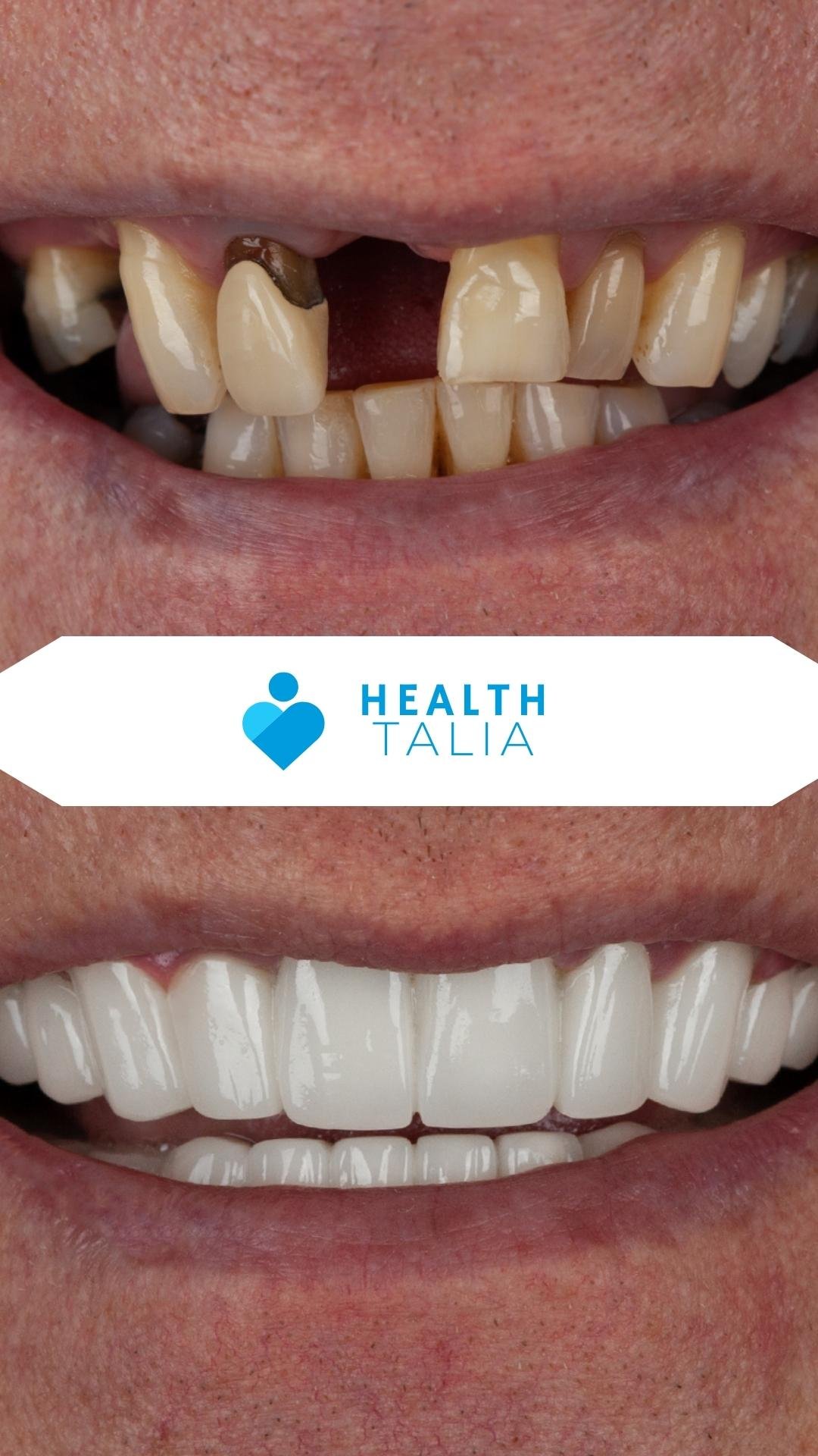 Free Consultation - Turkey Health Talia