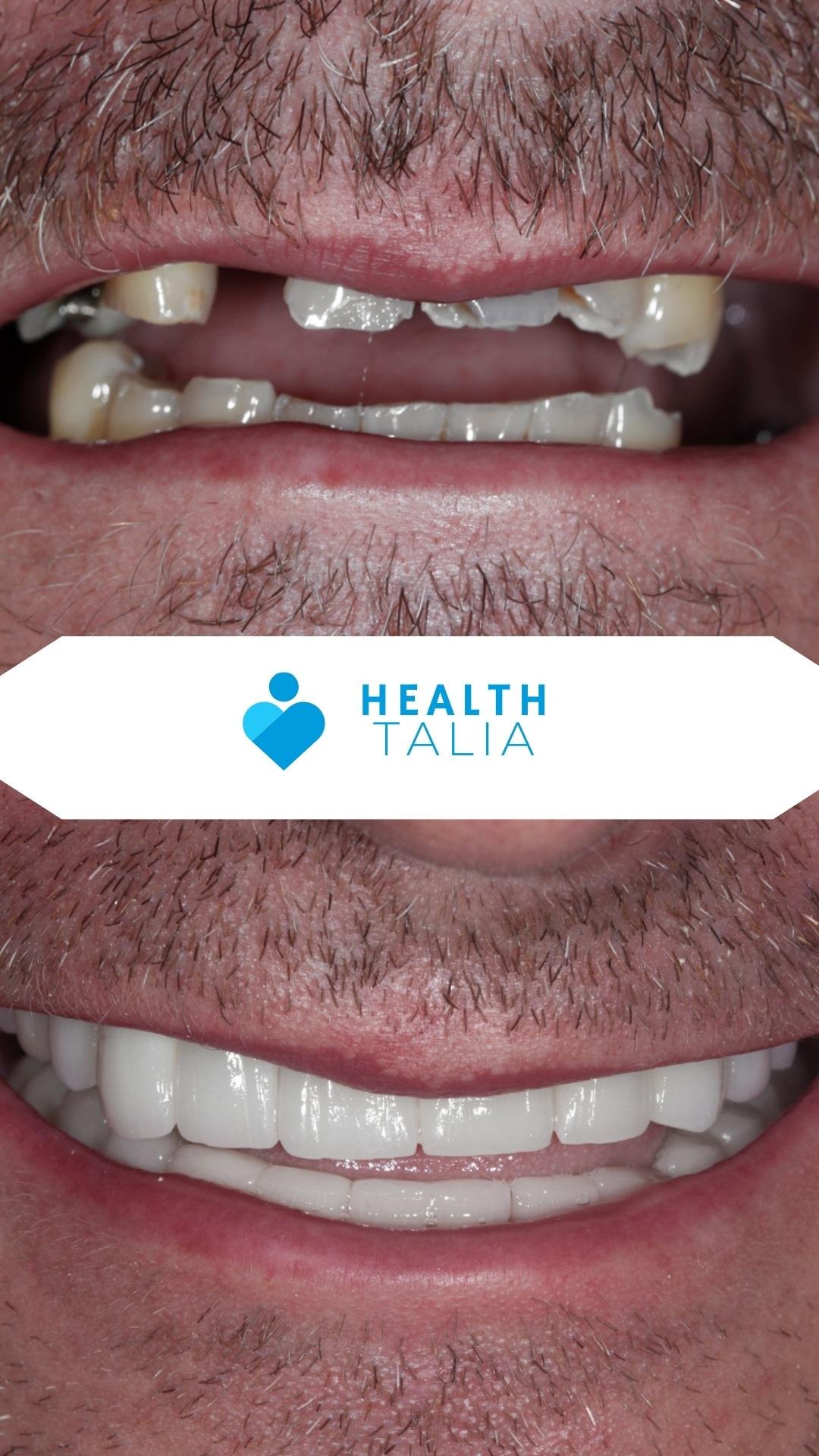 Free Consultation - Turkey Health Talia